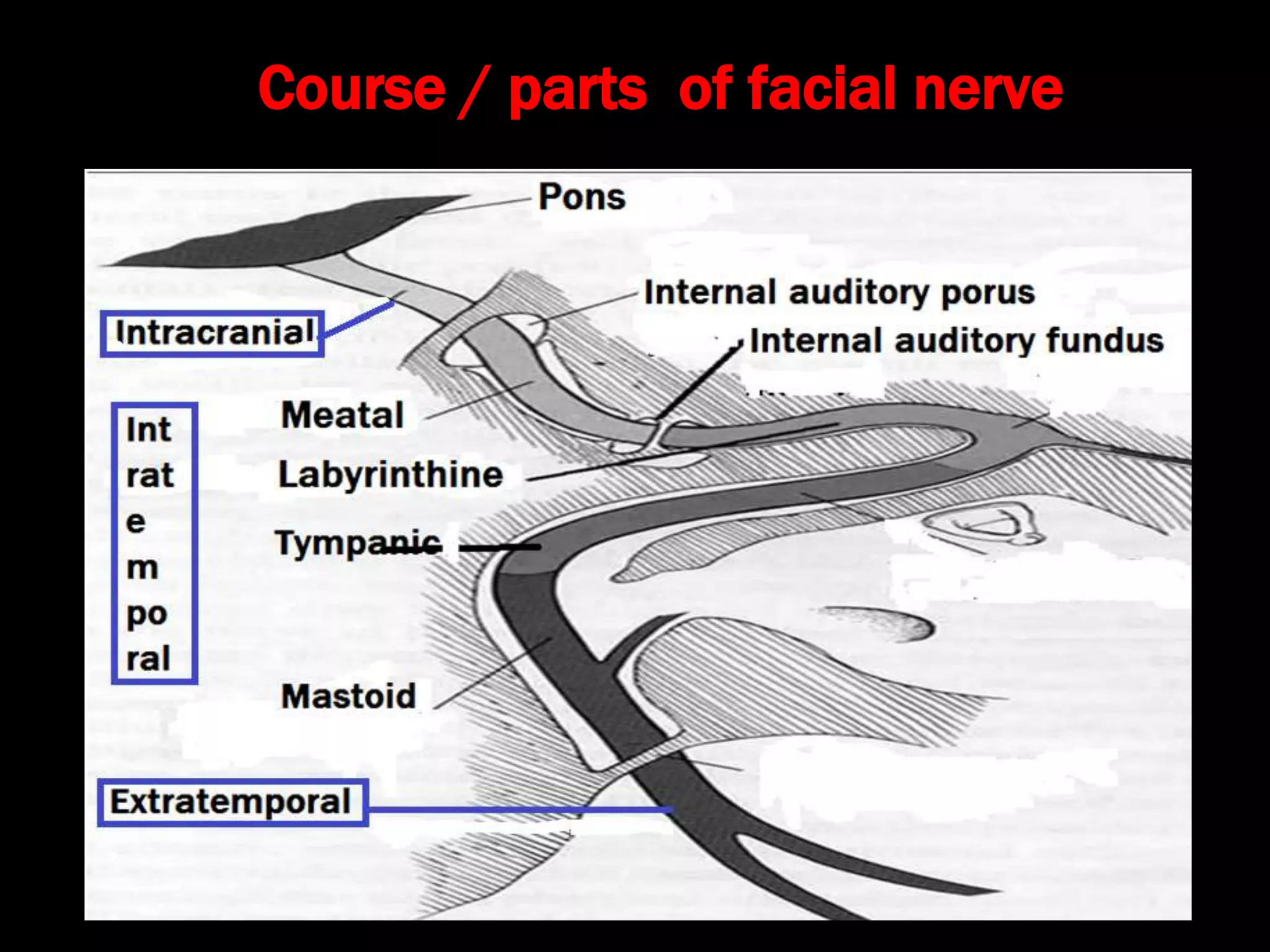 17. facial nerve palsy kk | PPT