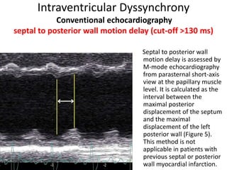 Echo assessment of CRT Candidates | PPT