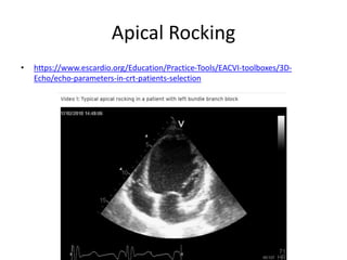 Echo assessment of CRT Candidates | PPT