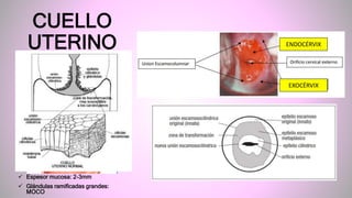 17.DISPLASIA CERVICAL.pptx