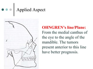 17. Maxillary sinus. antrum of highmore,surgical anatomy and its ...