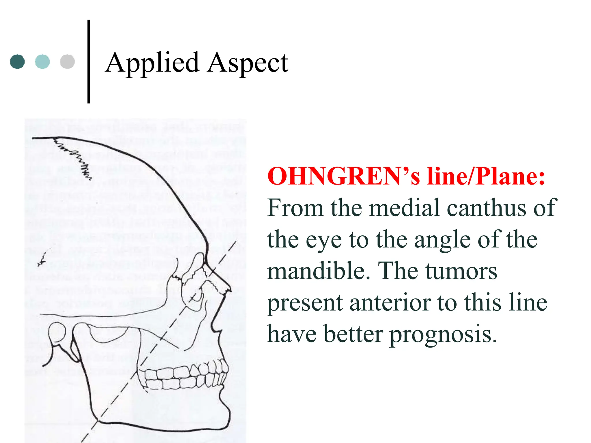 17. Maxillary sinus, antrum of highmore, surgical anatomy | PPTX