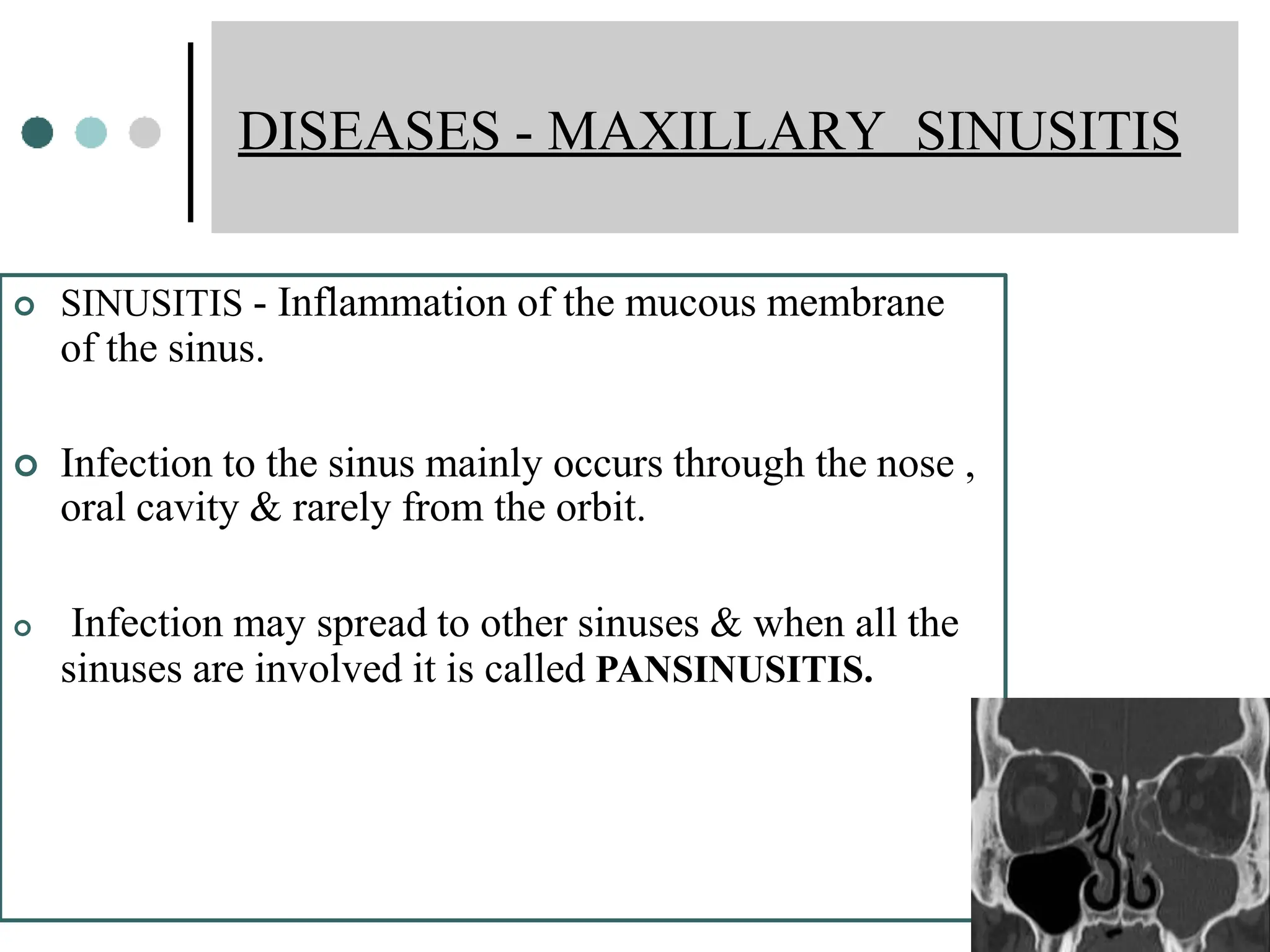 17. Maxillary sinus, antrum of highmore, surgical anatomy | PPTX