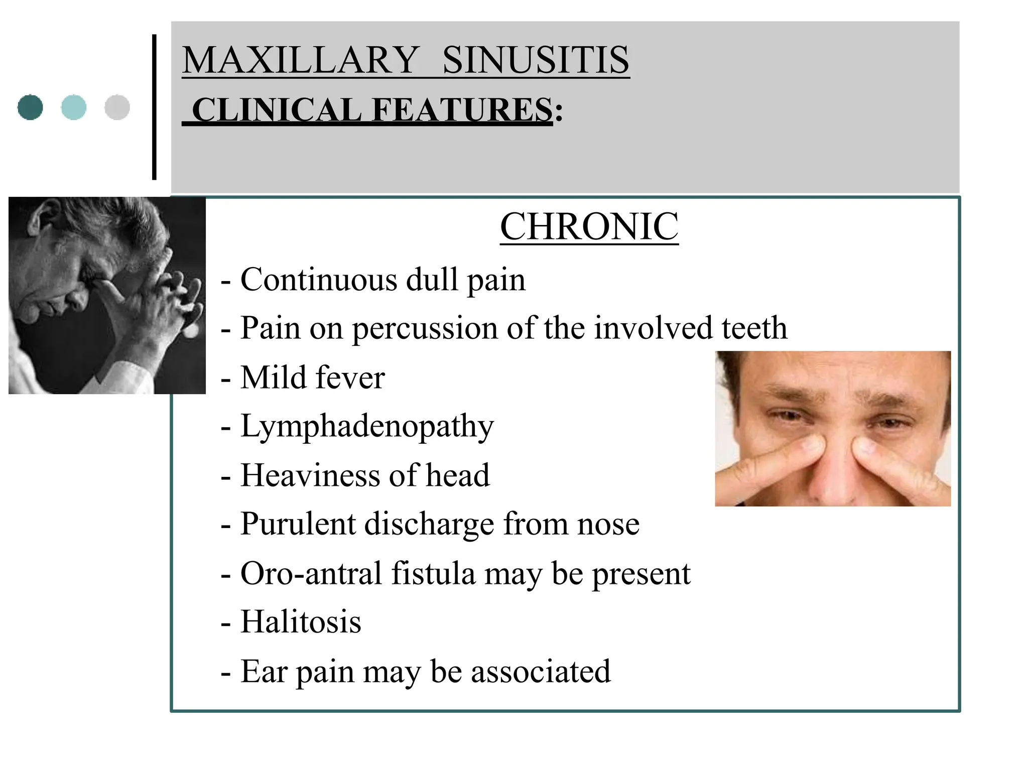 17. Maxillary sinus, antrum of highmore, surgical anatomy | PPTX