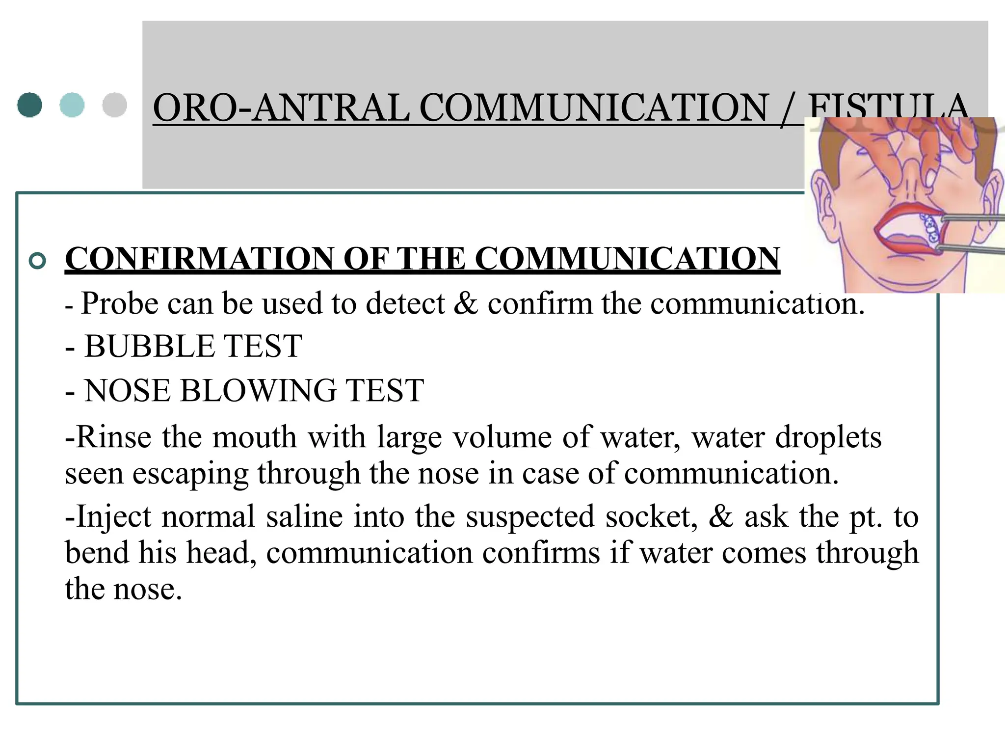 17. Maxillary sinus, antrum of highmore, surgical anatomy | PPTX