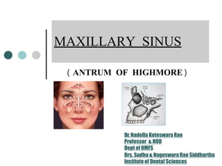 17. Maxillary sinus, antrum of highmore, surgical anatomy | PPTX