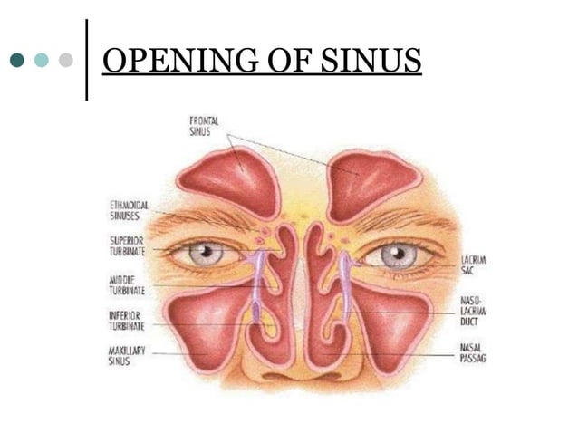 17. Maxillary sinus, antrum of highmore, surgical anatomy | PPTX