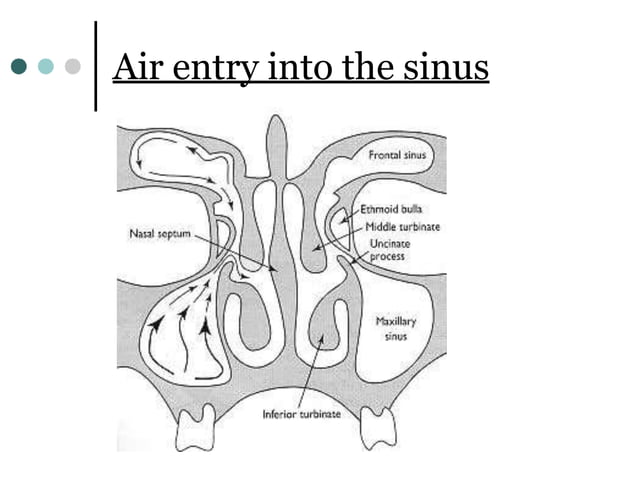 17. Maxillary sinus, antrum of highmore, surgical anatomy | PPTX