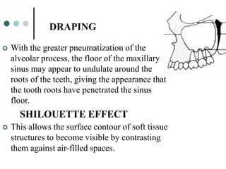 17. Maxillary sinus, antrum of highmore, surgical anatomy | PPTX