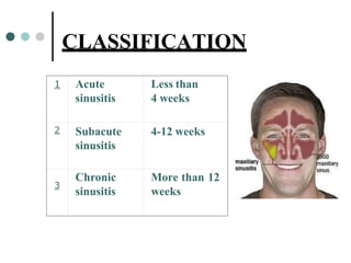 17. Maxillary sinus, antrum of highmore, surgical anatomy | PPTX