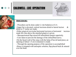 17. Maxillary sinus, antrum of highmore, surgical anatomy | PPTX