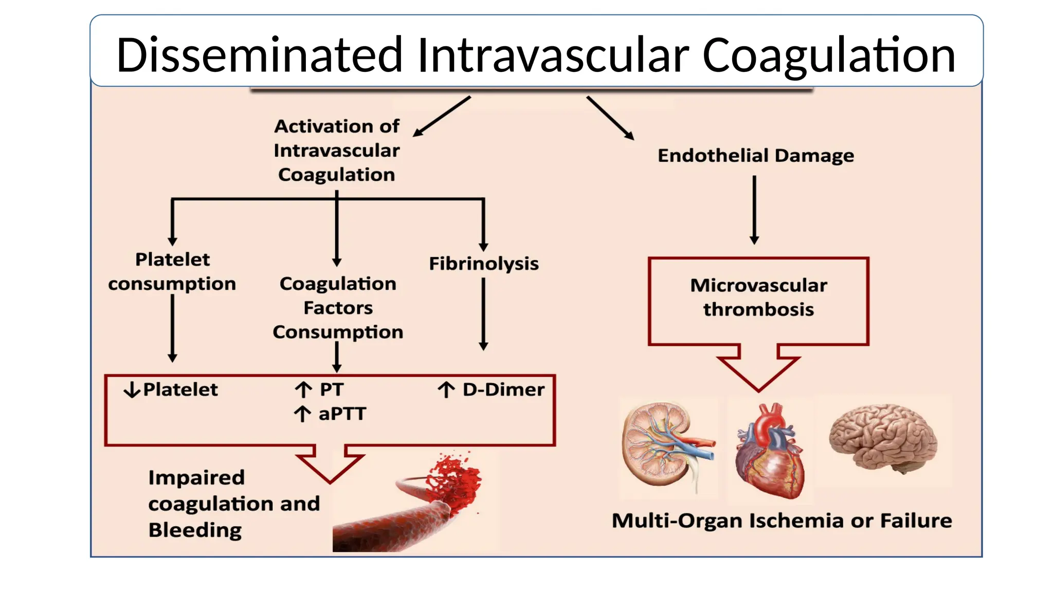 Disseminated Intravascular coagulation.pptx
