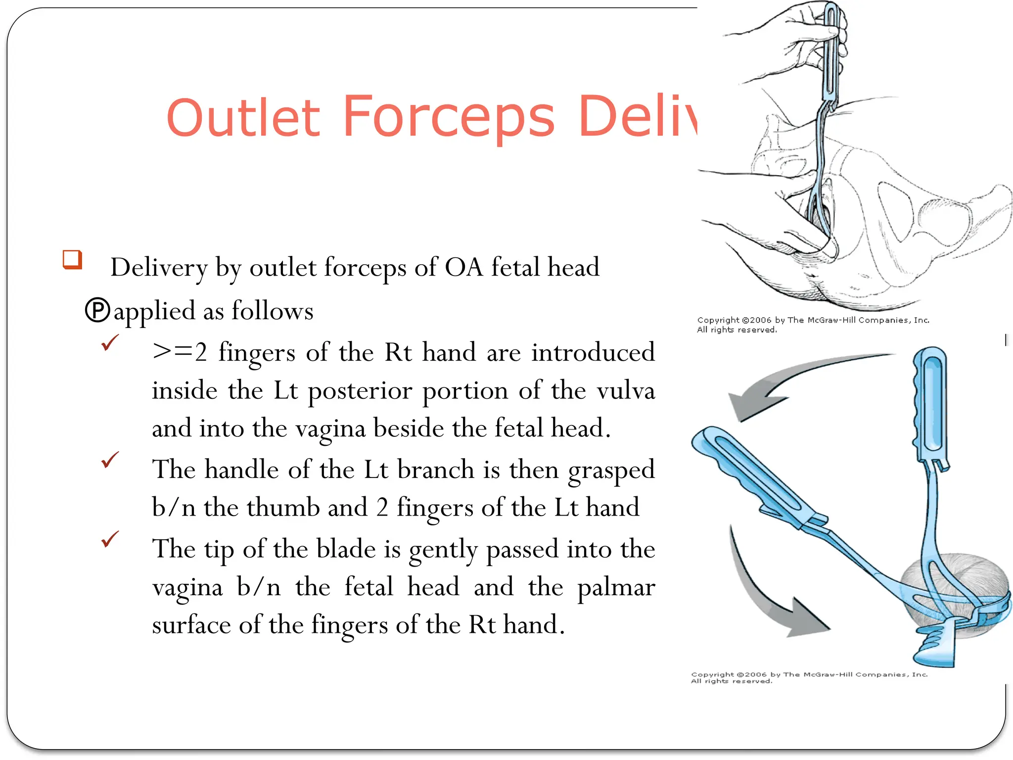 OPERATIVE VAGINAL DELIVERY FORCEPS AND V | PPT