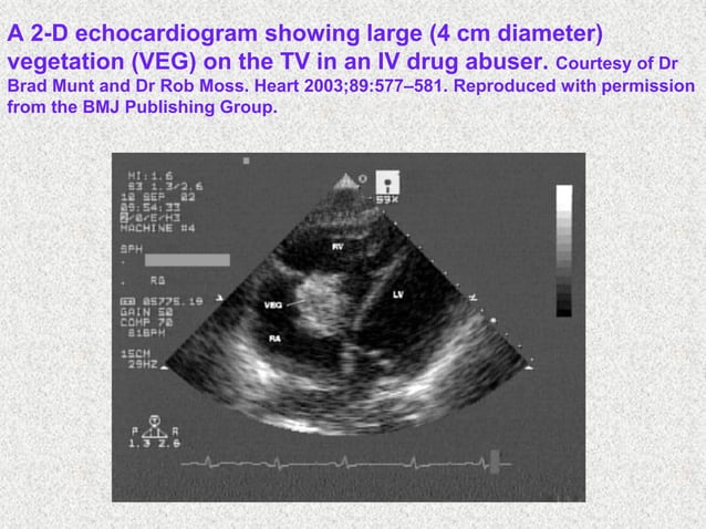 17. Viem noi tam mac- BS TRANG.pdfldlacf | PPT