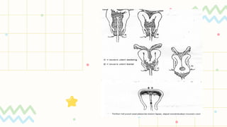 17-3A-HILDA-PPT INVERSIO UTERnjknkjI.pptx
