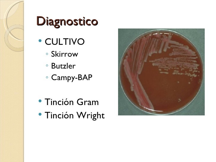 17. campylobacter jejuni