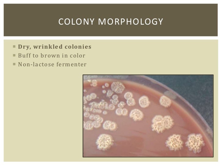 17 -chapter_21_-_non-fermenters