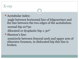 developmental dysplasia of the hip | PPT