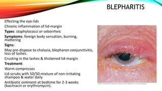 17- Eyelid and adnexal disorders.pptx