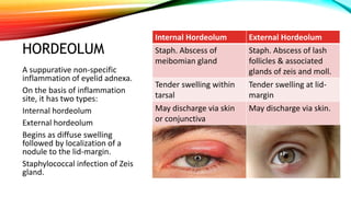 17- Eyelid and adnexal disorders.pptx