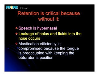 17. (new)implant retained maxillary obturators | PDF