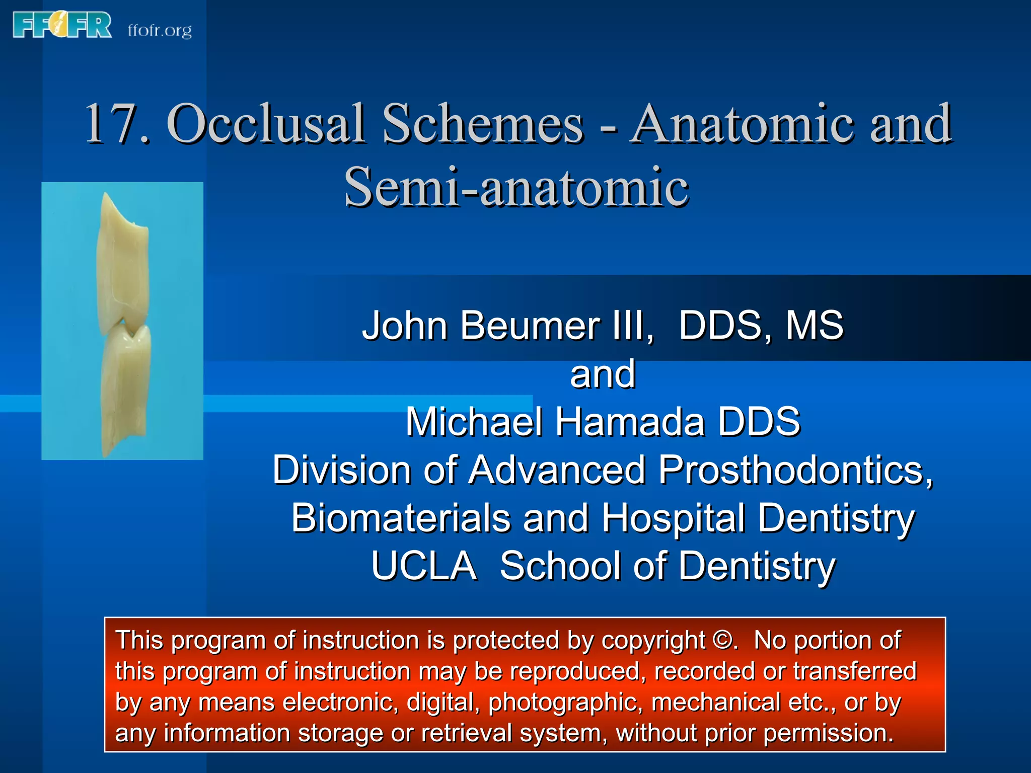 17.occlusal schemes anatomic and semiamatomic occlusion | PPT