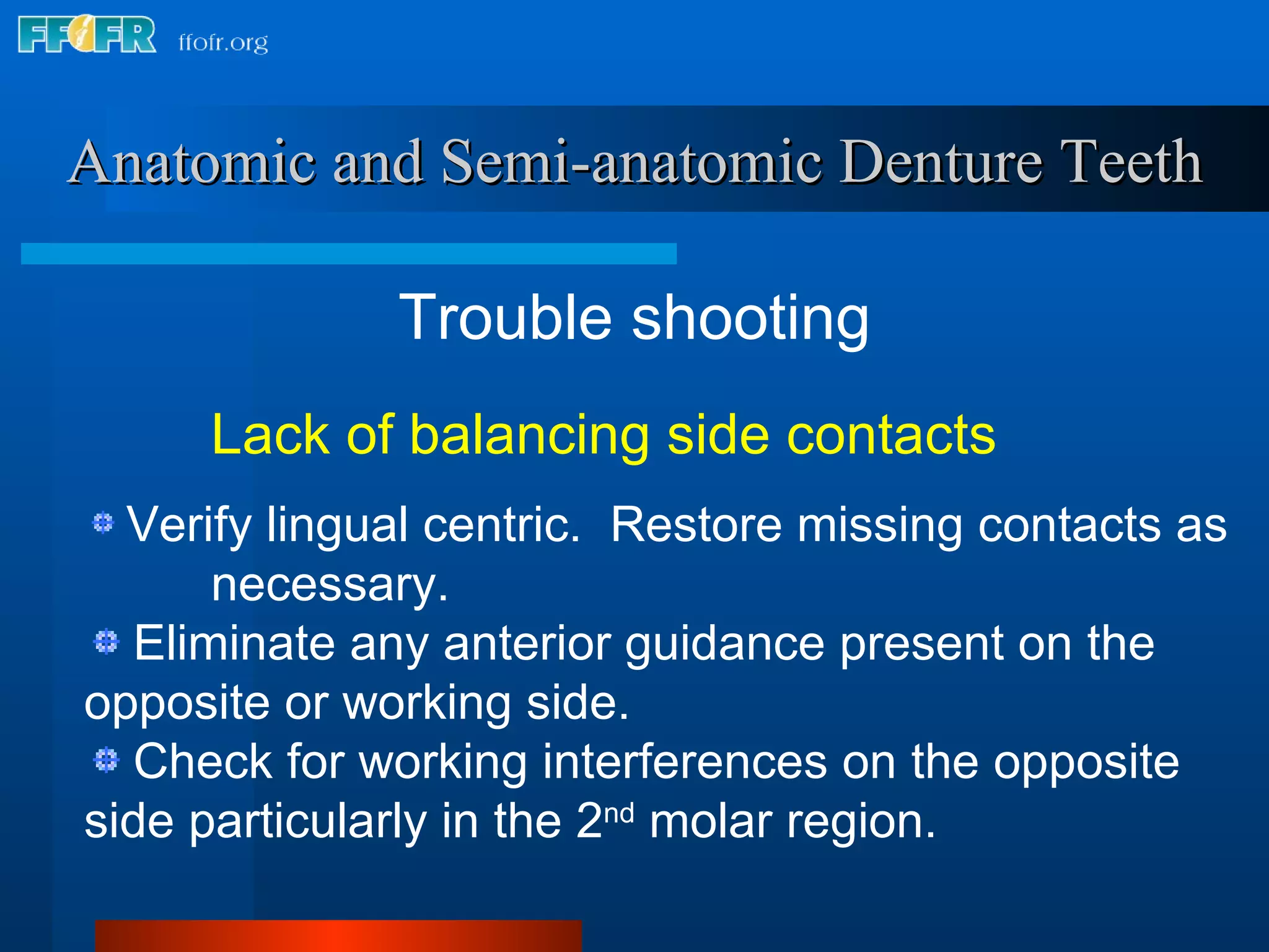 17.occlusal schemes anatomic and semiamatomic occlusion | PPT