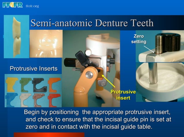 17.occlusal schemes anatomic and semiamatomic occlusion | PPT