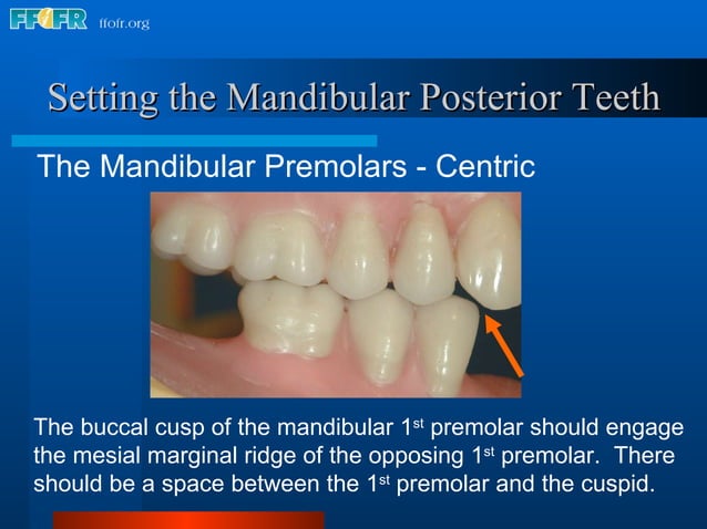 17.occlusal schemes anatomic and semiamatomic occlusion | PPT
