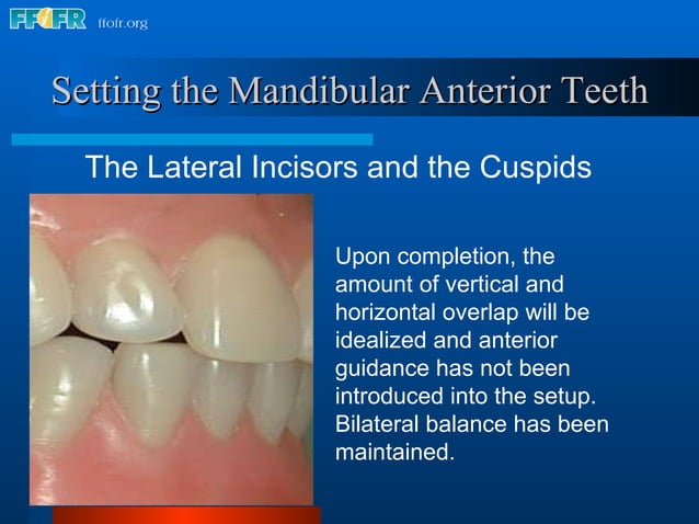 17.occlusal schemes anatomic and semiamatomic occlusion | PPT