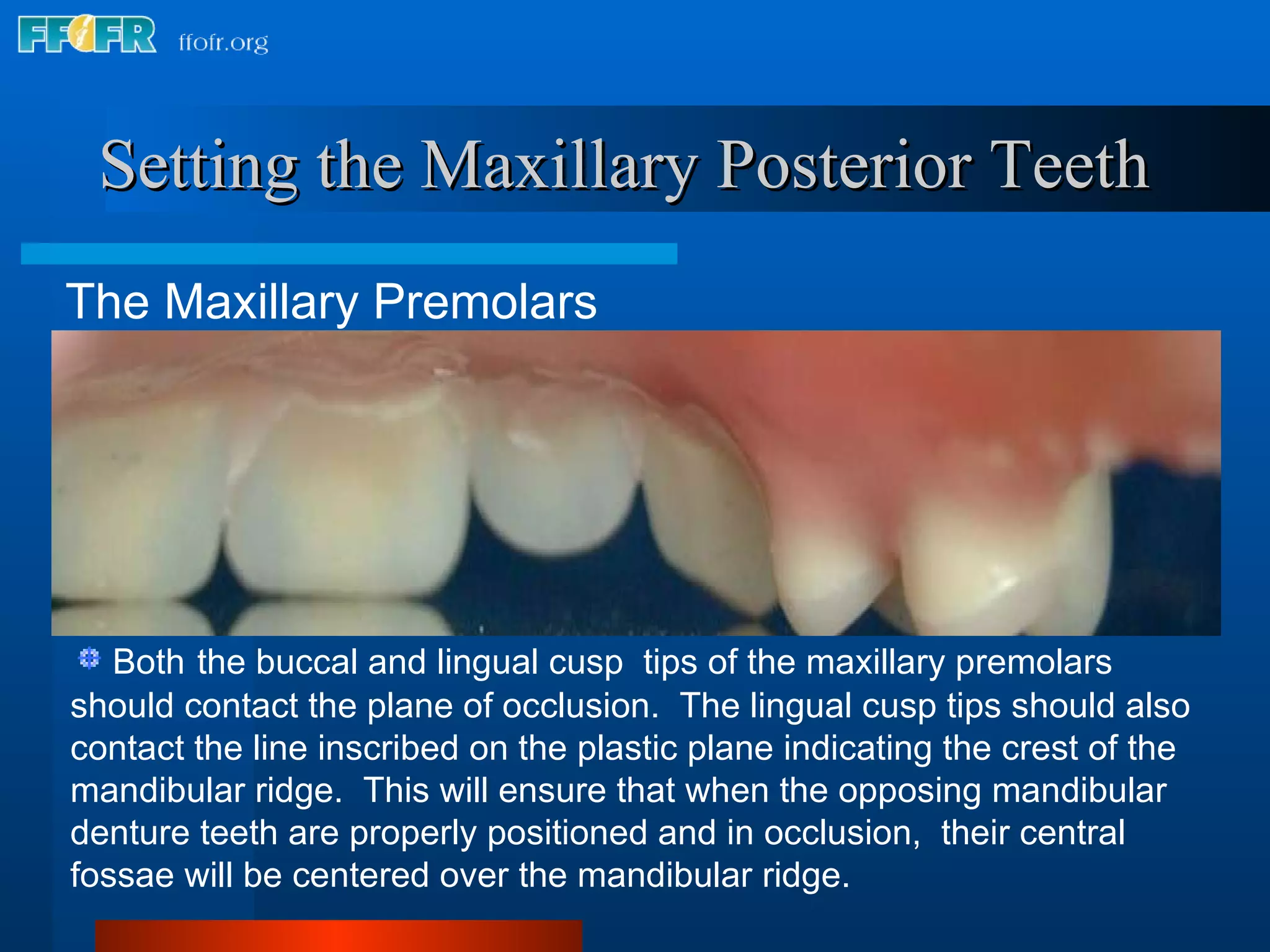 17.occlusal schemes anatomic and semiamatomic occlusion | PPT