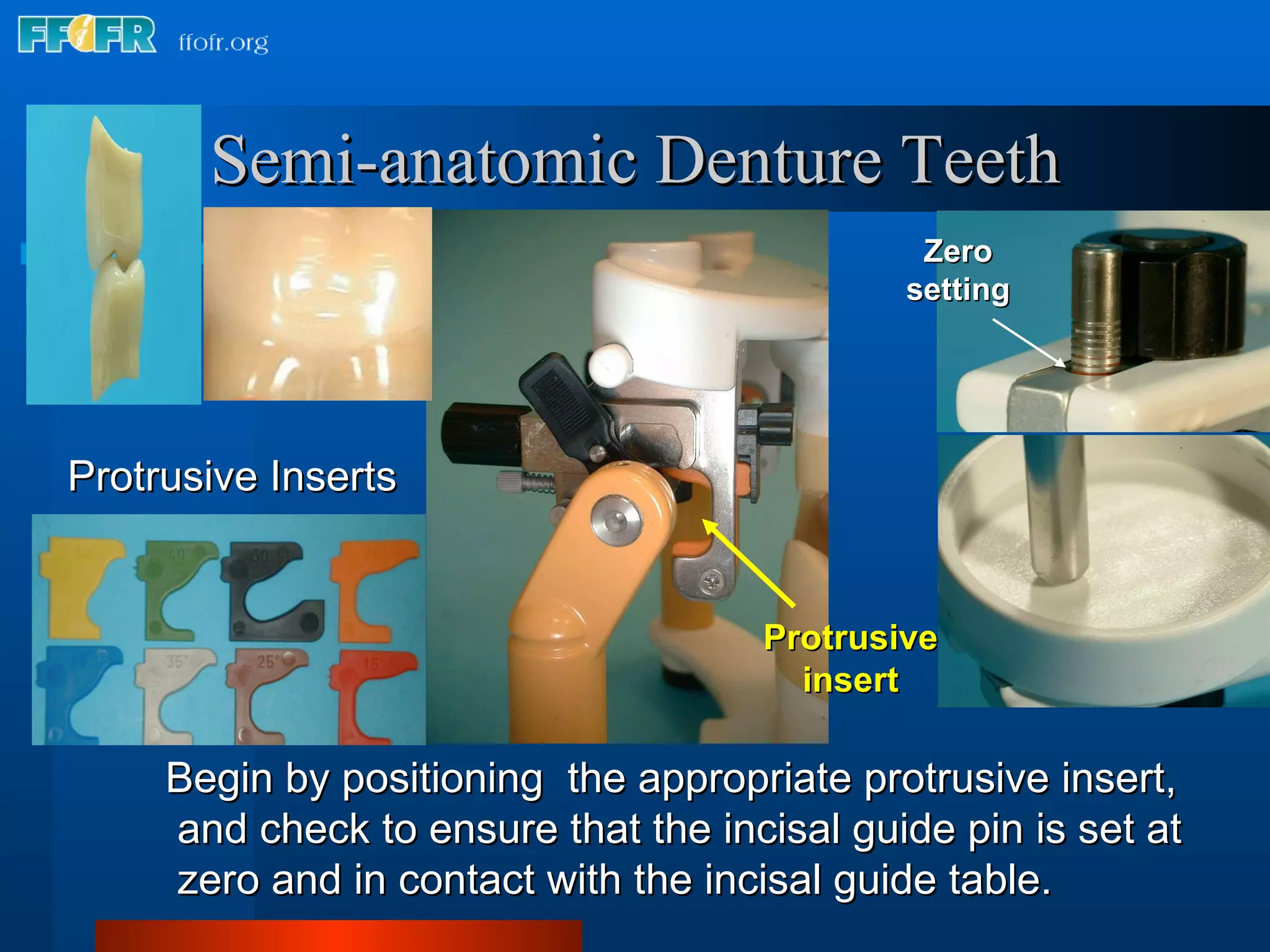 17.occlusal schemes anatomic and semiamatomic occlusion | PPT