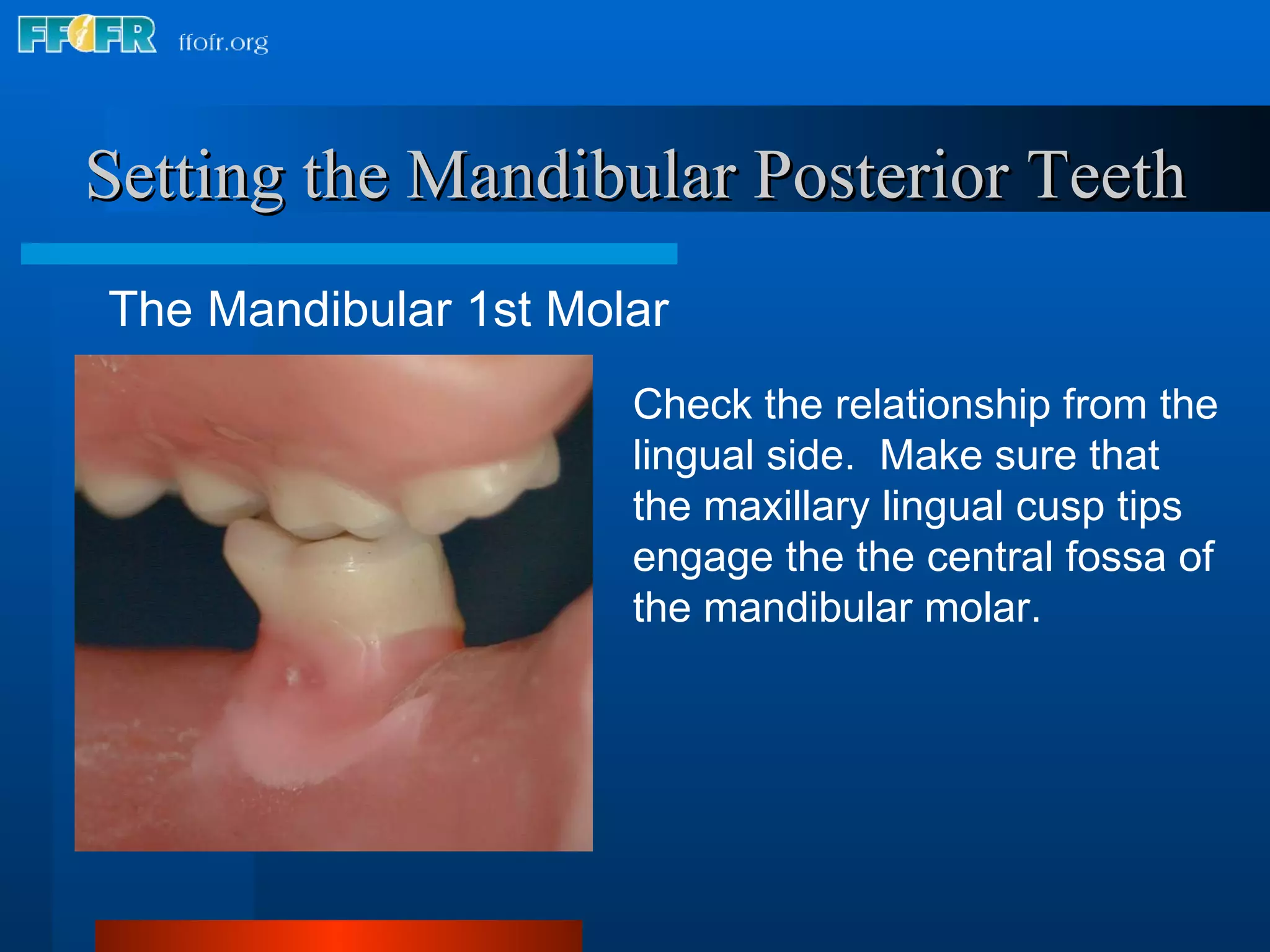 17.occlusal schemes anatomic and semiamatomic occlusion | PPT