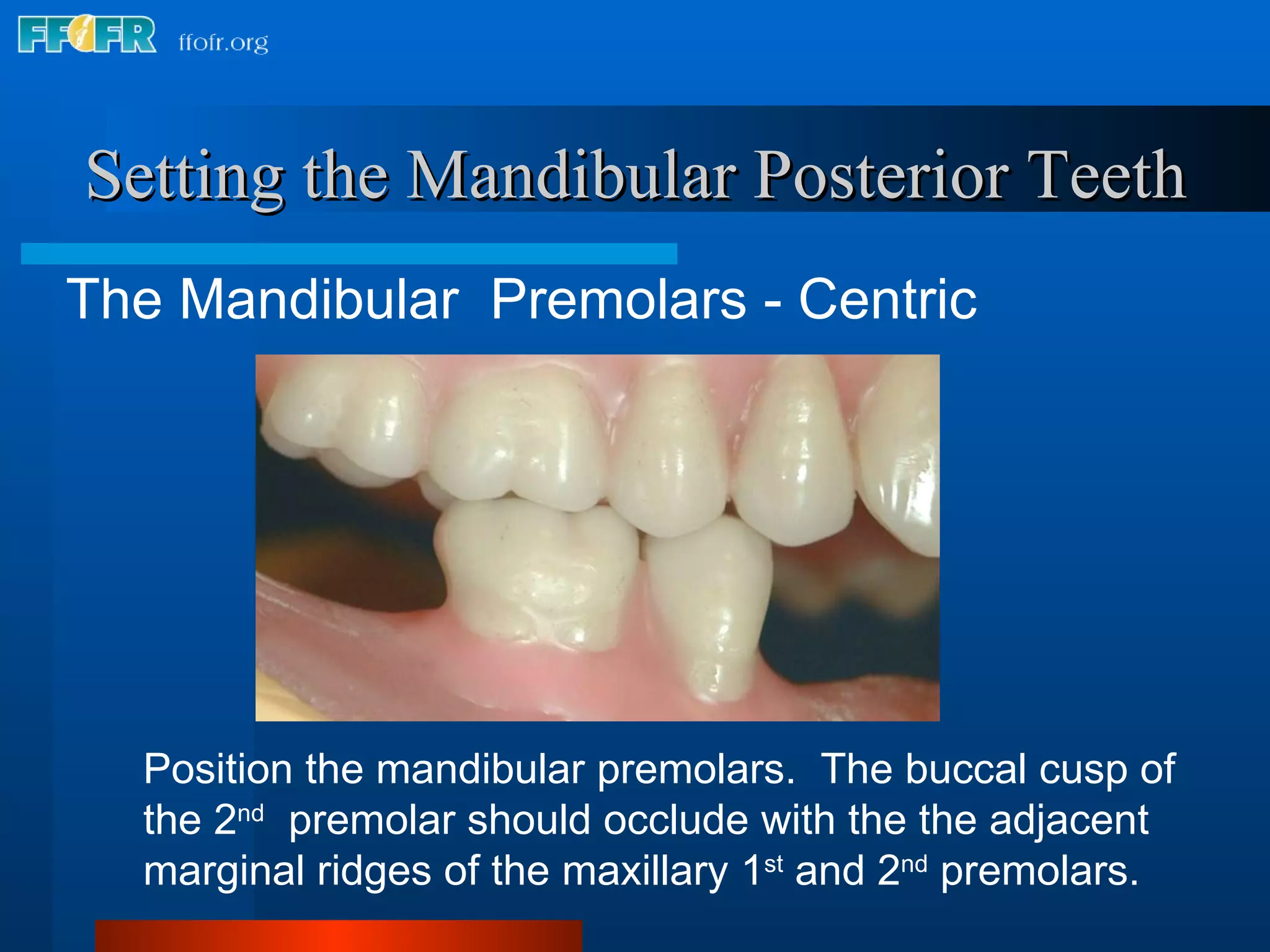 17.occlusal schemes anatomic and semiamatomic occlusion | PPT
