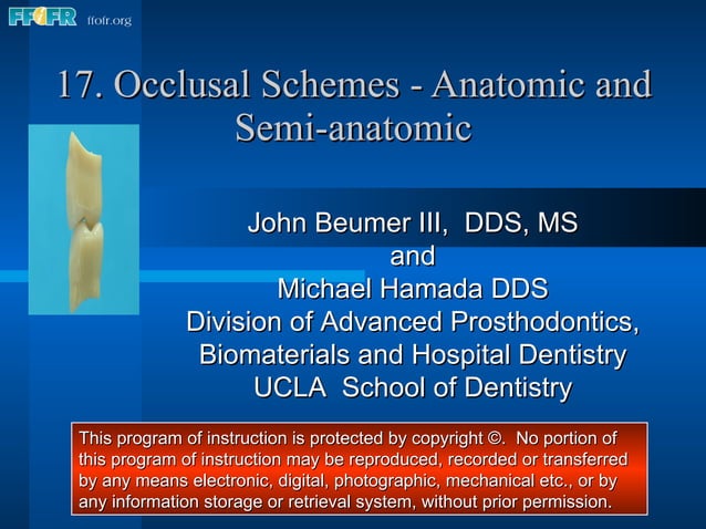 17.occlusal schemes anatomic and semiamatomic occlusion | PPT