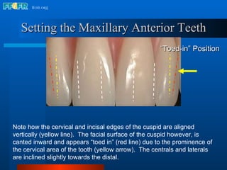 17.occlusal schemes anatomic and semiamatomic occlusion | PPT