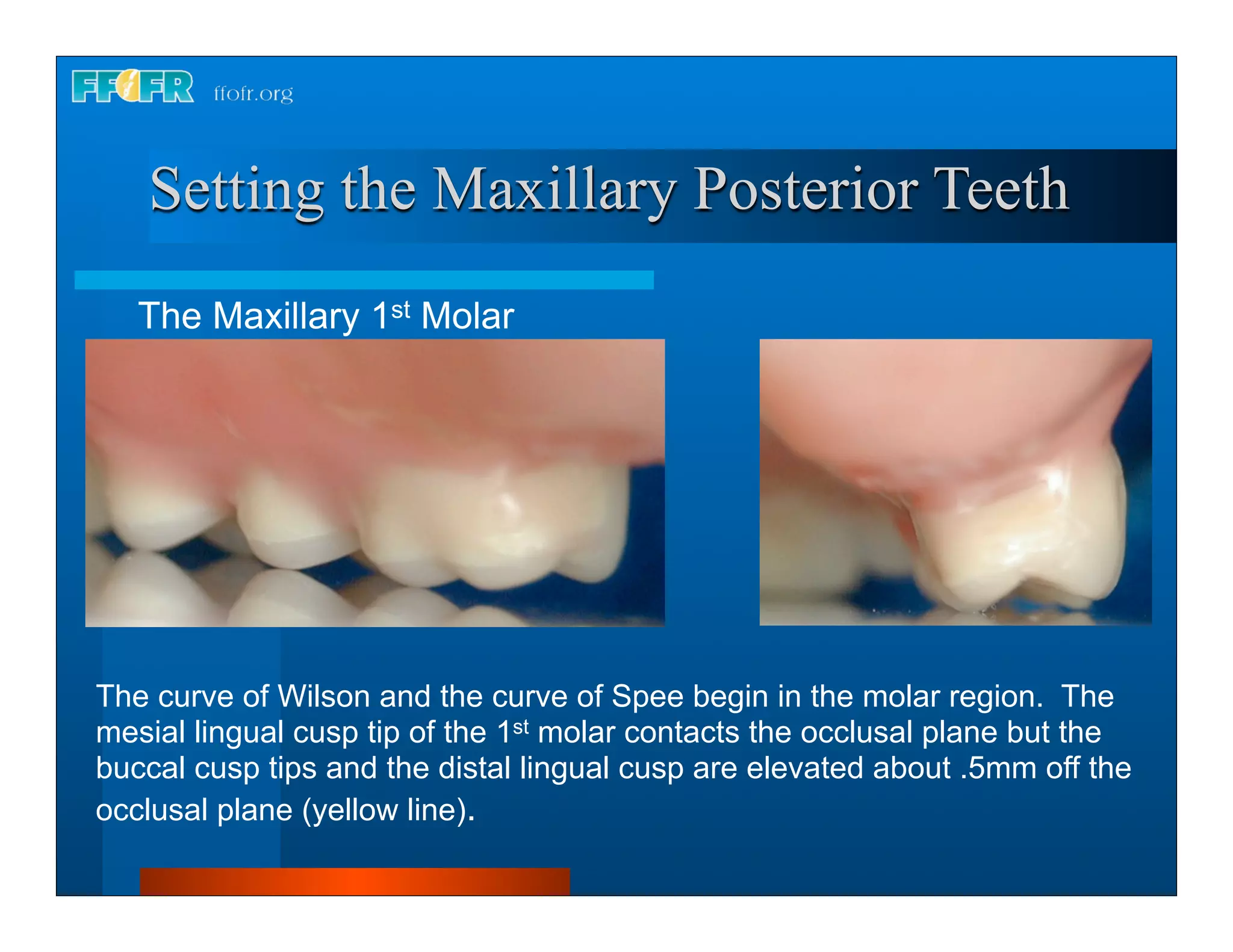 17.occlusal schemes anatomic and semiamatomic occlusion | PDF