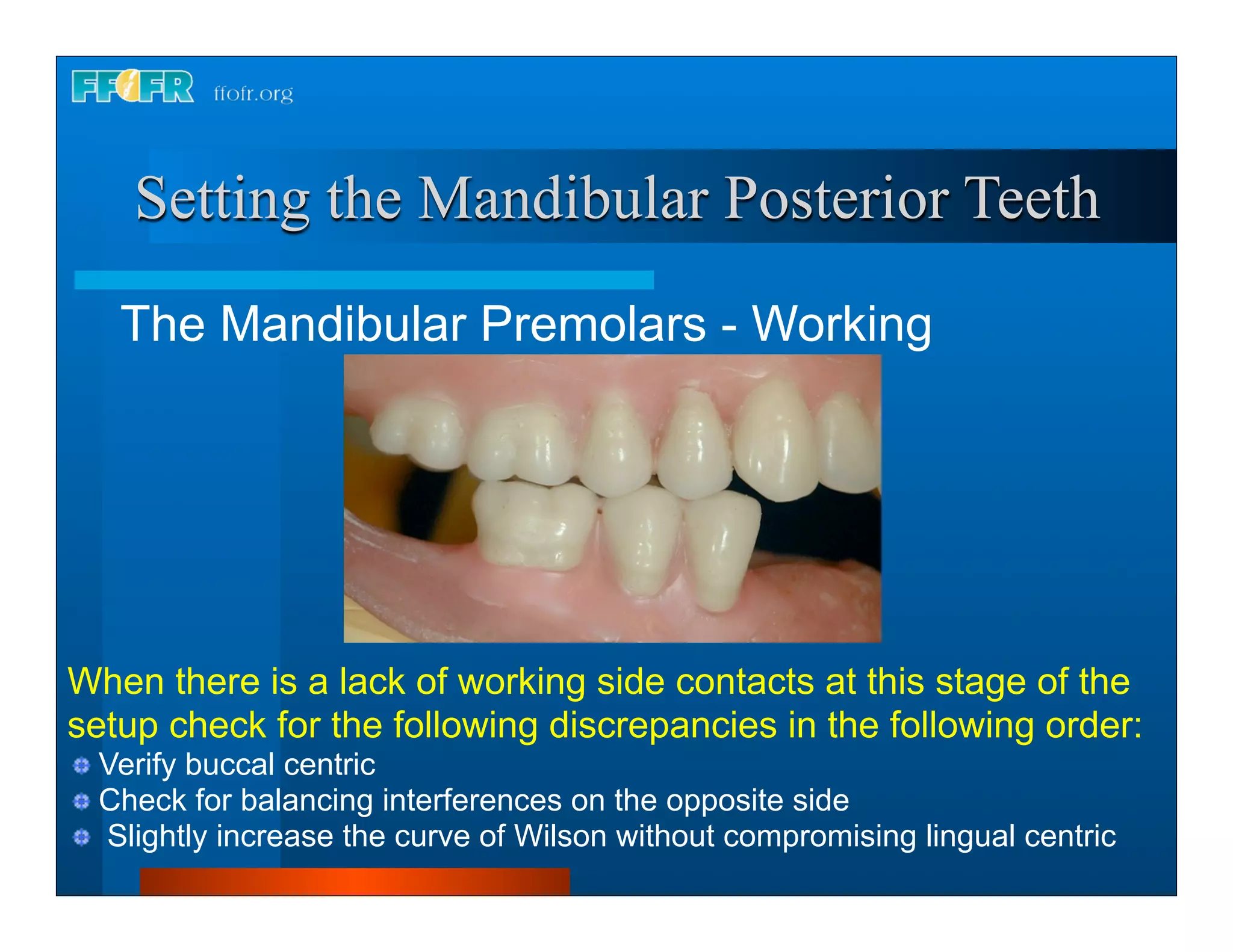17.occlusal schemes anatomic and semiamatomic occlusion | PDF