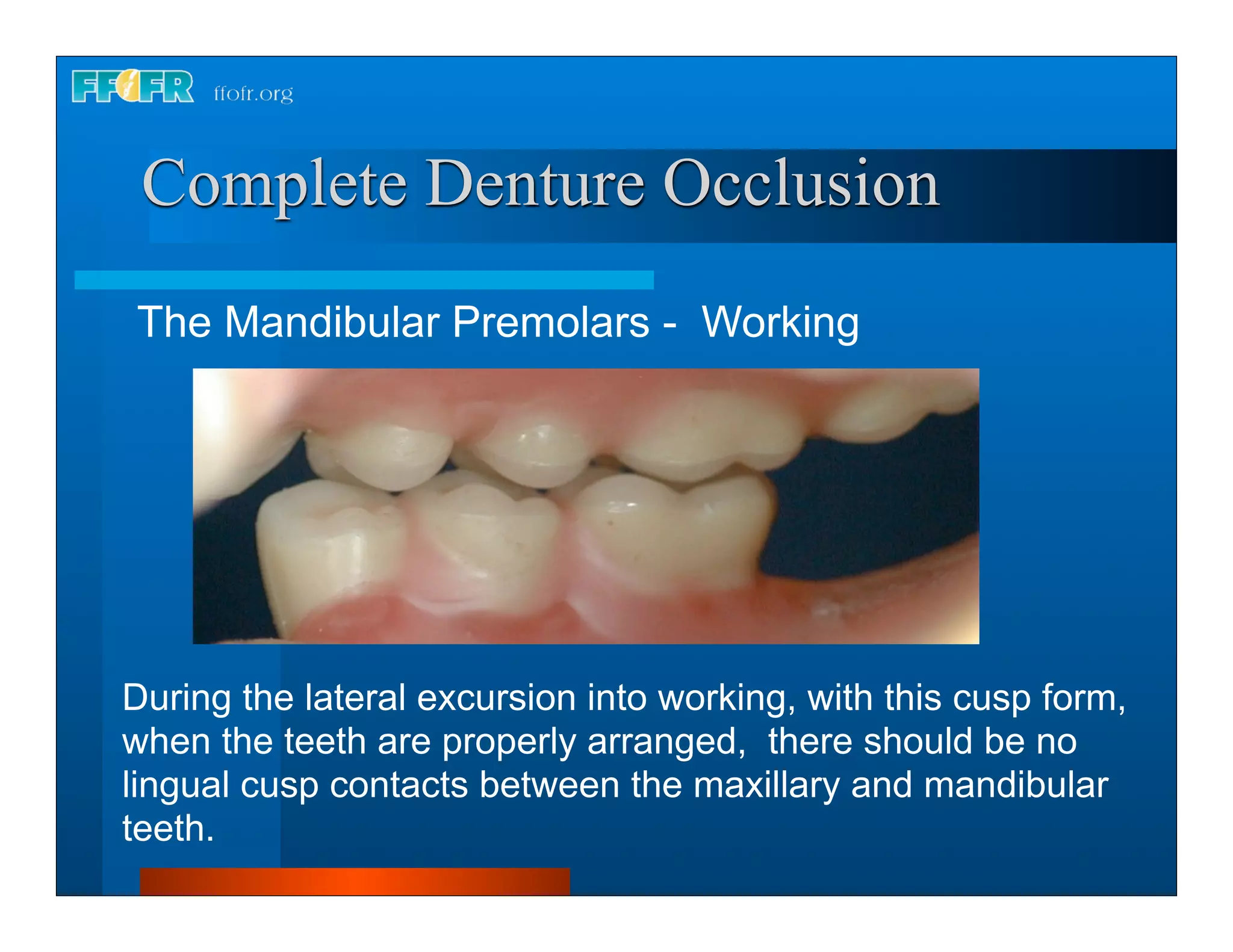 17.occlusal schemes anatomic and semiamatomic occlusion | PDF