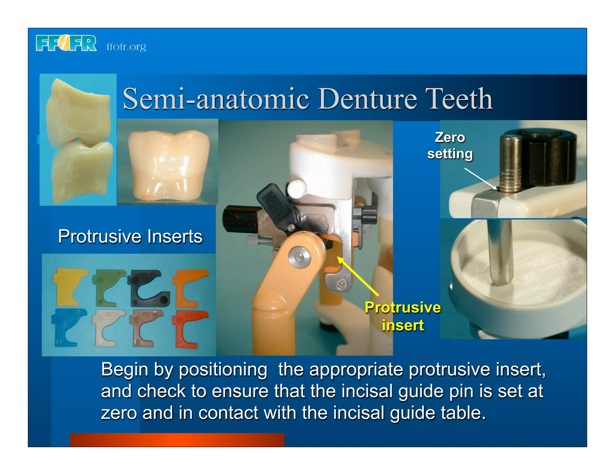 17.occlusal schemes anatomic and semiamatomic occlusion | PDF