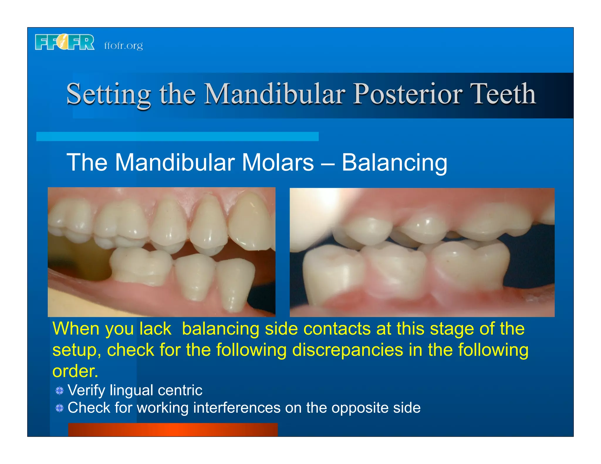 17.occlusal schemes anatomic and semiamatomic occlusion | PDF