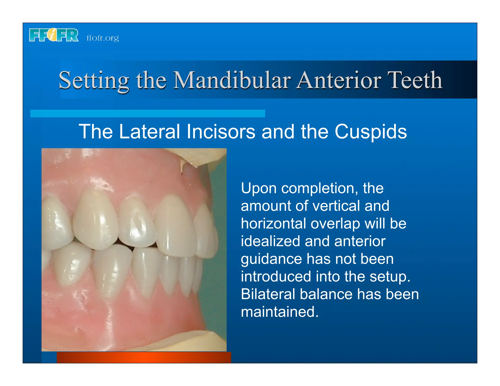 17.occlusal schemes anatomic and semiamatomic occlusion | PDF