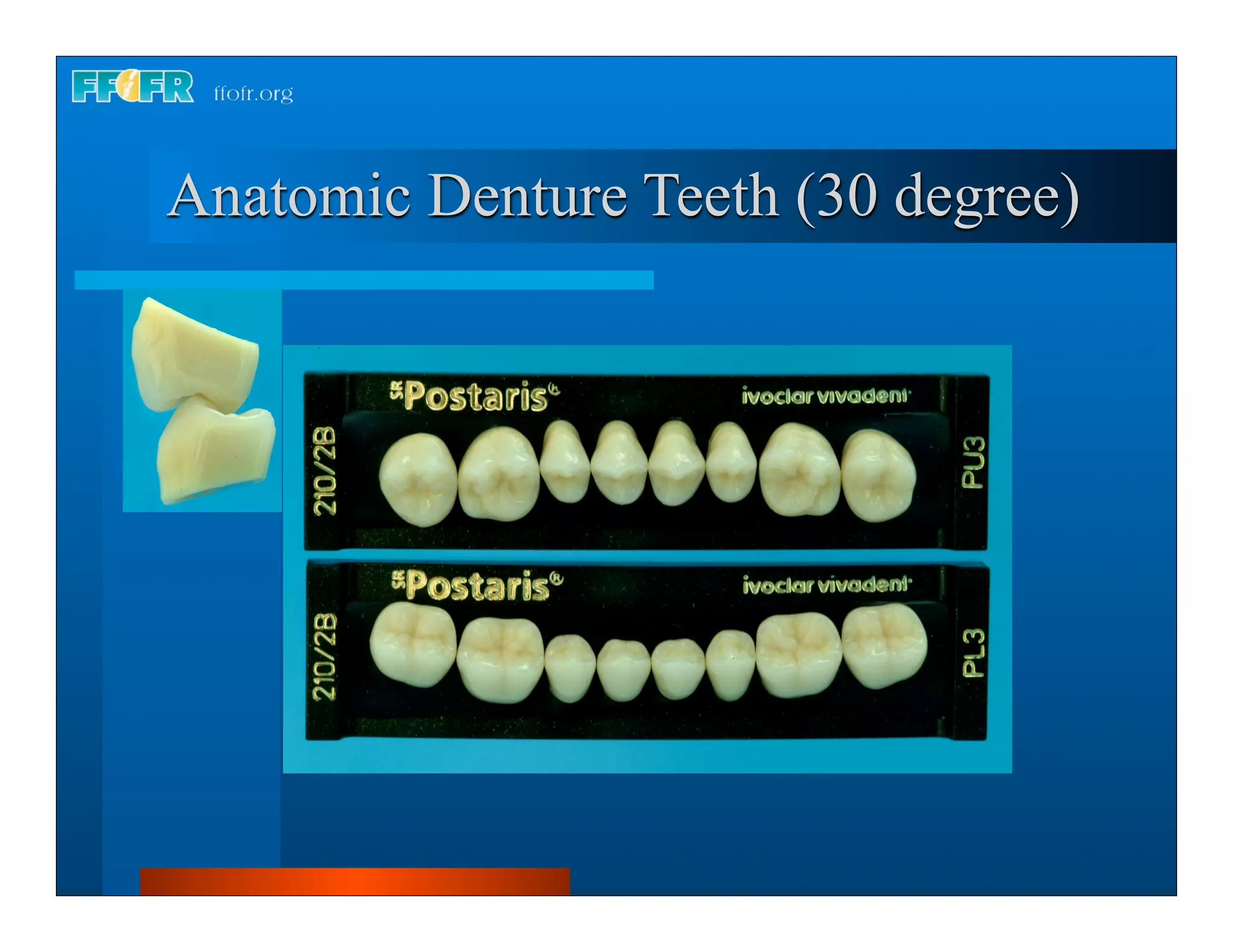 17.occlusal schemes anatomic and semiamatomic occlusion | PDF