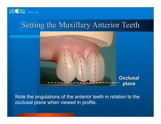 17.occlusal schemes anatomic and semiamatomic occlusion | PDF