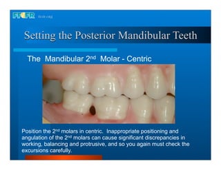 17.occlusal schemes anatomic and semiamatomic occlusion | PDF