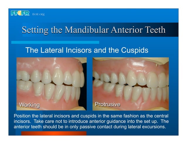 17.occlusal schemes anatomic and semiamatomic occlusion | PDF | Dental ...