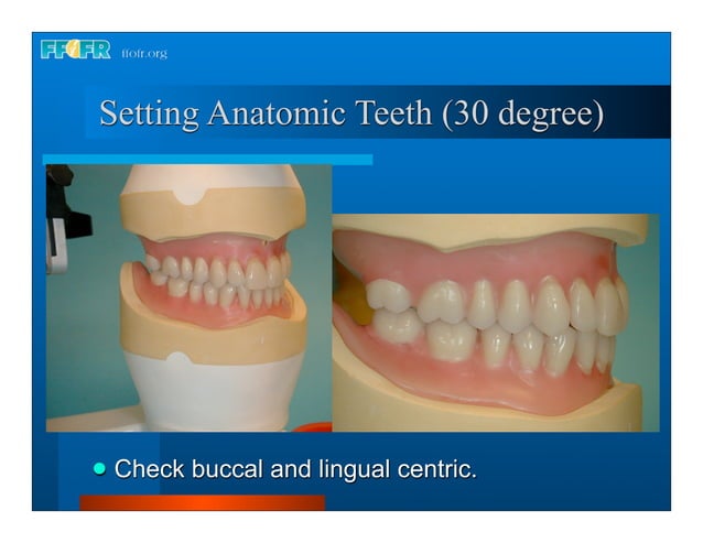 17.occlusal schemes anatomic and semiamatomic occlusion | PDF | Dental ...