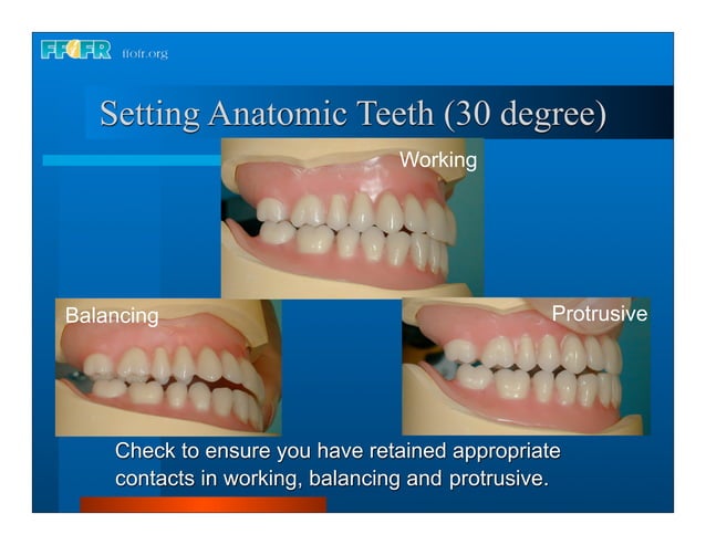 17.occlusal schemes anatomic and semiamatomic occlusion | PDF | Dental ...