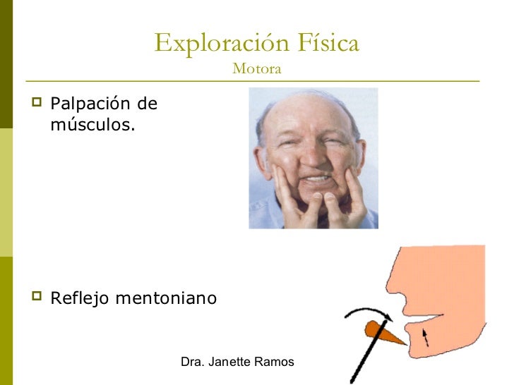 17 pares-craneales-1201130538583042-4