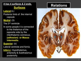 17- Thalamus & Limbic System (3).ppt